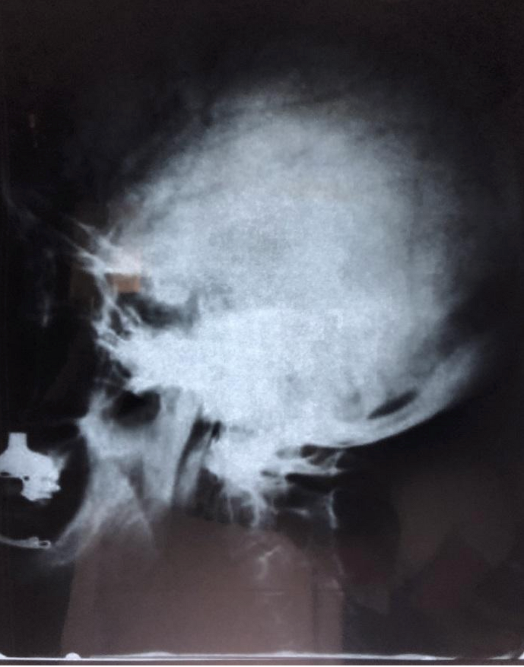 [Einstein, Albert. (1879 - 1955)] Photograph of Einstein's Brain Waves ...